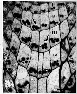 Position of Statoliths in Statocytes from Cress Roots under Changing ...