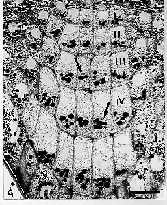 Position of Statoliths in Statocytes from Cress Roots under Changing ...